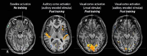 Visual Cortex Fmri