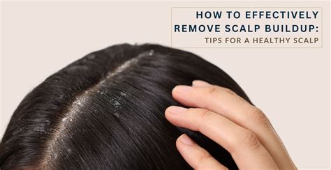 How To Effectively Remove Scalp Buildup For A Healthy Scalp Clinikally