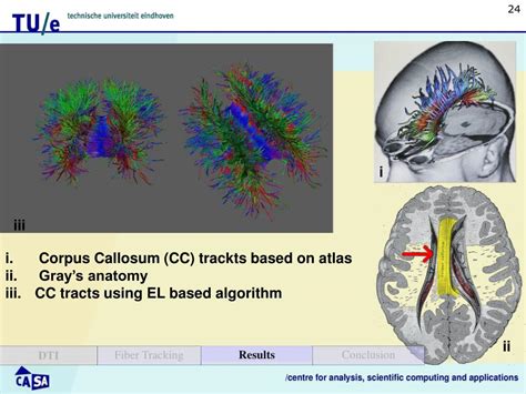Ppt Multi Valued Geodesic Based Fiber Tracking For Diffusion Tensor Imaging Powerpoint