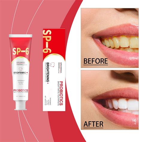 Probiotic Toothpaste For Teeth Cleaning And Hygiene Reducing Stains