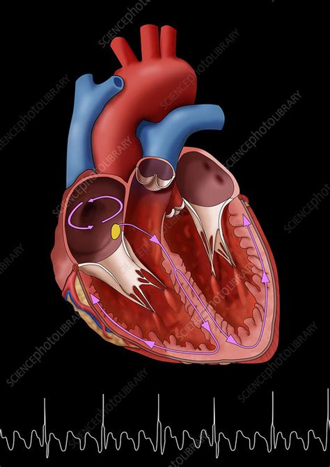 Atrial Flutter With EKG Illustration Stock Image C
