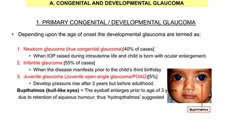 Glaucoma Pptx