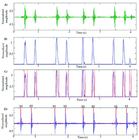 Stages Of Segmentation A Ewt Component Heart Sound B Nase Of The