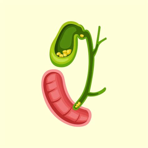 Gallbladder And Duodenum With Gallstones Medical Illustration Premium