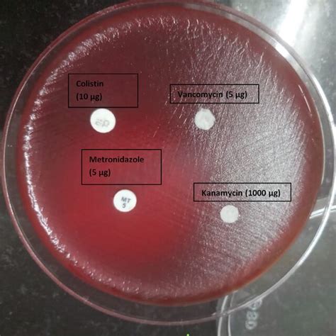 Identification Of Bacteroides Fragilis Group Using Discs Vancomycin 5