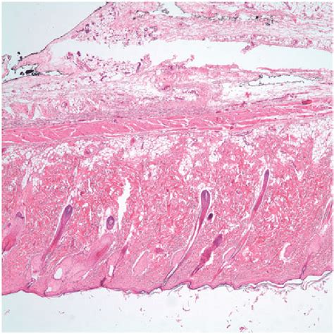 Histologic Appearance Of The Control Group The Normal Histologic