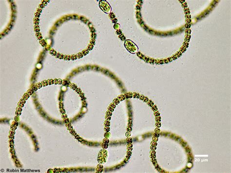 Cyanobacteria Nostocales Aphanizomenonaceae Dolichospermum Circinale Dolichospermum 556 