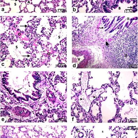 Sections In The Lung Stained With H E A And B Control Group