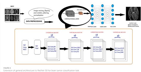 Figure 6 From A Fine Tuned Vision Transformer Based Enhanced Multi Class Brain Tumor