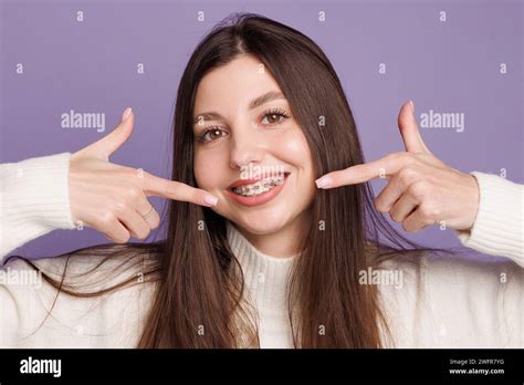 Portrait Of A Girl With Braces Woman Happy With Braces Shows Ok Sign Stock Photo Alamy