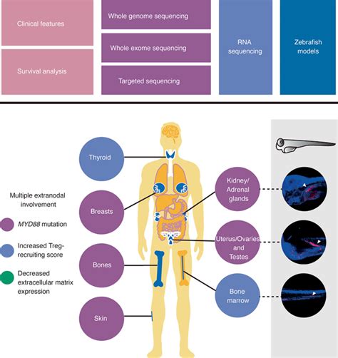 Influence Of Oncogenic Mutations And Tumor Microenvironment Alterations On Extranodal Invasion