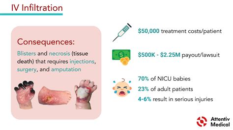 Iv Flow Rate Calculation Formulas