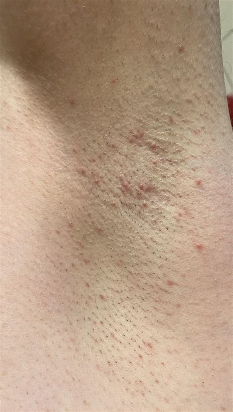 Morning Stubble And Smell 😶 R Armpitvoyeur