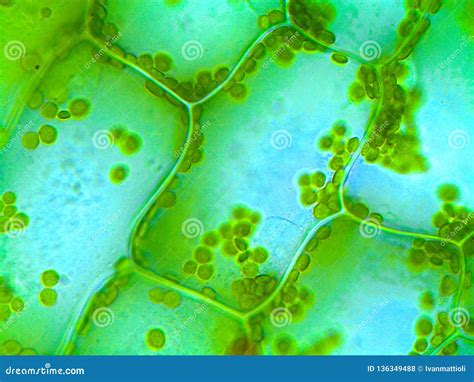 Elodea Cells Under A Microscope