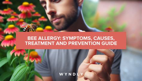 Bee Allergy Comprehensive Guide To Symptoms And Treatment 2025 And Wyndly