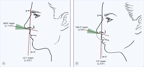Pyriform Aperture Pocket Dentistry
