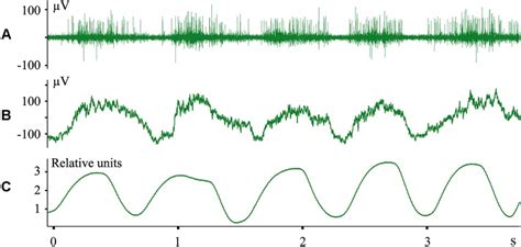Neuronal Activity In The Cat Primary Visual Cortex Synchronized With