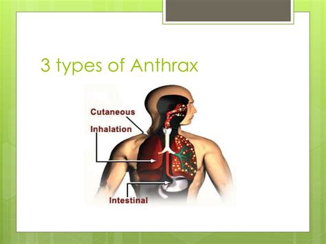 Ppt Anthrax Powerpoint Presentation Free Download Id 2863629