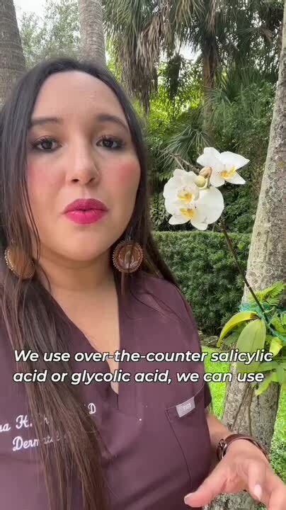 Milia Video Realself