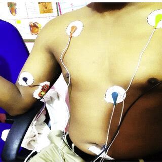 Final Prototype Of IoT Based Monitoring System For Epileptic Patients Download Scientific Diagram