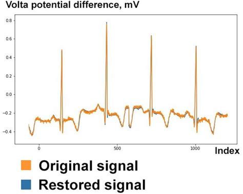 Figure 6 From Ecg Analysis Software Library Based On Nlp And Ml Methods
