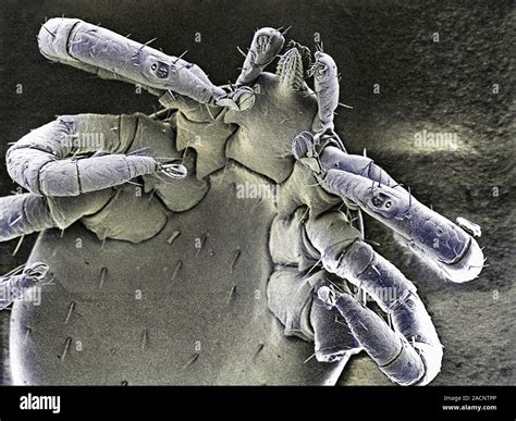 Tick Coloured Scanning Electron Micrograph Sem Of The Underside Of A Tick Order Ixodida