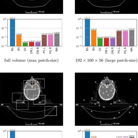 Average Background And Organ Volume Imbalance Ratios Of Seven Han