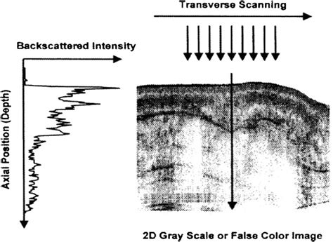 Example OCT B Mode Scan Of Tissue Formed From A Sequence Of Axial Line Download Scientific