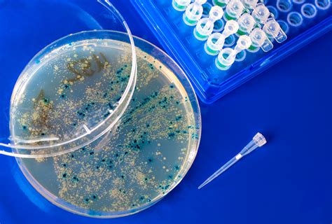 噬菌体展示文库及噬菌体展示技术对肿瘤学的贡献 知乎