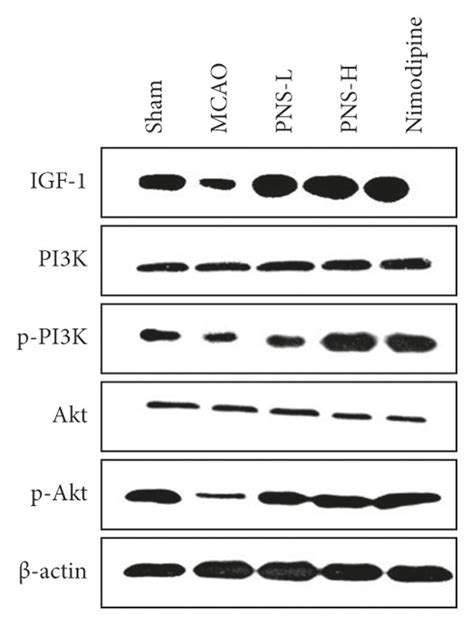 The Effects Of Pns On The Igf Pi3k Akt Pathway A The Igf1 Akt Download Scientific Diagram