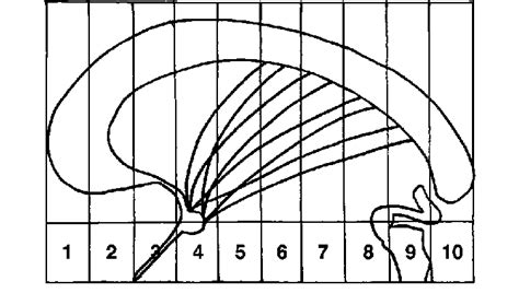 Schematic Illustration Of The Insertion Of The Fornix With The Corpus Download Scientific