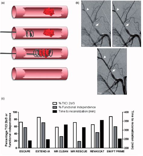 Thrombectomy
