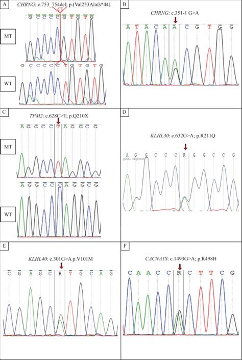 Electropherograms Showing Genetic Particularities In Tunisian Escobar Download Scientific