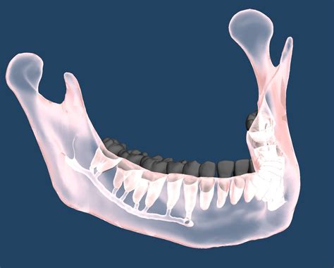 Maxillary And Mandibular Dental Model Full Set 3d Model Collection My Xxx Hot Girl