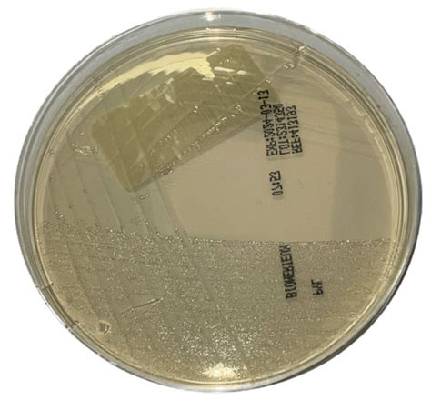 Detection By Real Time Pcr Of Helicobacter Pylori And Clarithromycin Resistance Compared To