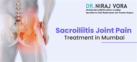 Sacroiliitis Faqs Treatment Options Sacroiliitis Symptoms Bhby