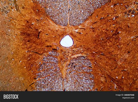 Cross Section Spinal Image And Photo Free Trial Bigstock
