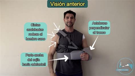Hombro Congelado Capsulitis Adhesiva Cuánto Dura