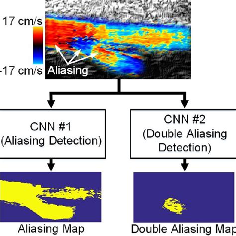 Pdf A Deep Learning Approach To Resolve Aliasing Artifacts In Ultrasound Color Flow Imaging