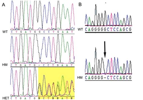 Electropherograms Of The Mutations Detected In Protocadherin 21