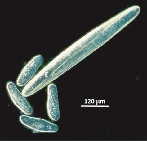 Epulopiscium Fishelsoni