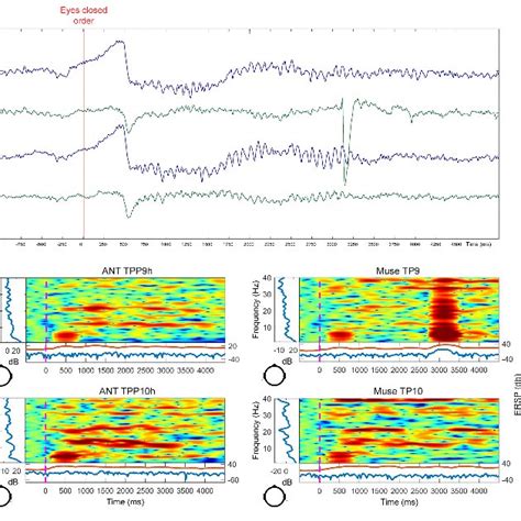 Comparative Analysis Of The Same Single Eeg Trial Simultaneously Download Scientific Diagram