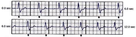 Primary Sensing Vector Snapshot Download Scientific Diagram