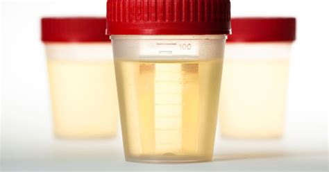 Specific Gravity Of Urine Renew Physical Therapy