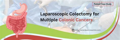 Laparoscopic Colectomy For Colonic Cancers Expert Care