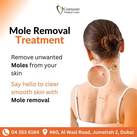 Mole Removal Treatment Cosmocare Medical Center