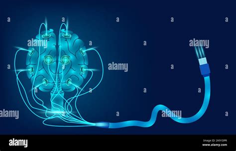 A Cartoon Drawing Of A Brain With Transcranial Magnetic Stimulation Stock Vector Image And Art Alamy