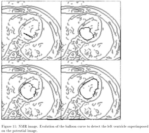 On Active Contour Models And Balloons Opencv Qanda Forum