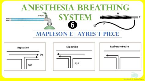 Mapleson E Ayres T Piece Anesthesia Breathing System6 Youtube