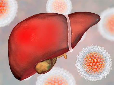 Hepatitis Everything You Need To Know